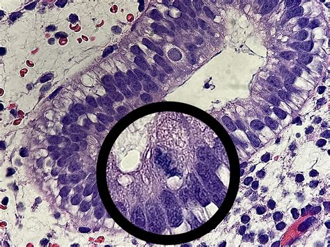 Need Help Understanding Mitochondrial Assays With Mitotracker Dyes R Biology