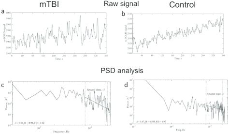 Raw Signal And Power Spectrum Analysis A Sample Raw Rs BOLD Signal Download Scientific