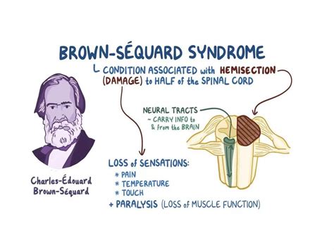 Upper Motor Neuron Lower Motor Neuron And Brown Sequard Syndrome Pptx
