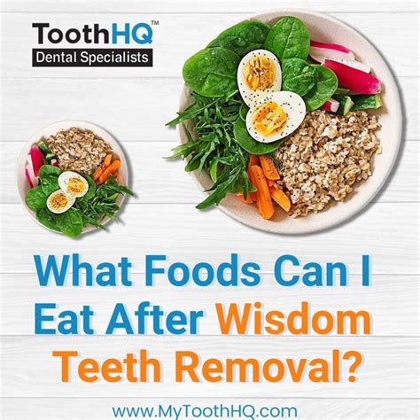 What Foods Can I Eat After Wisdom Teeth Removal Toothhq Dental