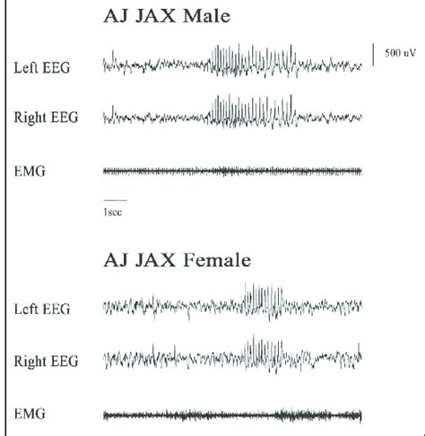 example of spike and wave discharge swd events from 2 a j jax mice