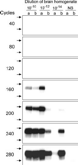 Sensitivity Of Detection Of Hamster Scrapie Sc237 Using Sequential Download Scientific Diagram