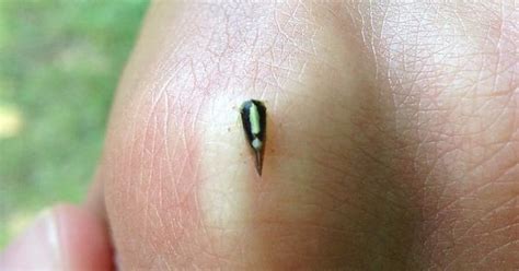 This Bug Looks Like Its Always Excited Imgur