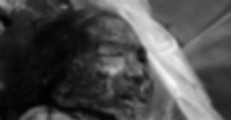 미라 첫 부검 유전자 분석 성공17세기 문경 미라 사인은 동맥경화증 심혈관 질환