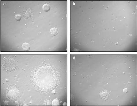 Effects Of The Tyrosine Kinase Inhibitor Ag1478 On The Growth Of