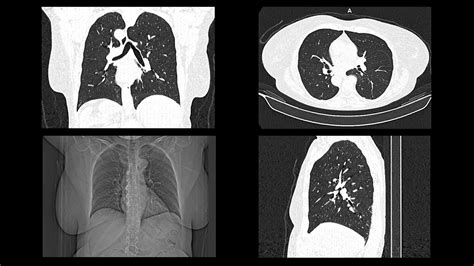 Somatom Goup Made To Match Siemens Healthineers Usa