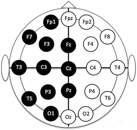1020 System Electrode Placement Download Scientific Diagram