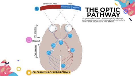 Optic Pathway And Visual Fields Genially