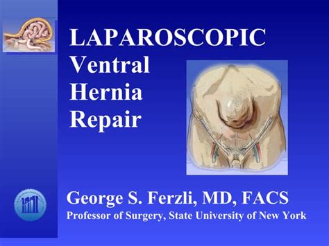 Laparoscopic Ipom Plus Pptx