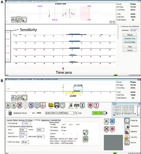 LS Scan Test And LS Setup On The OMNI II Programmer A LS Channel Download Scientific Diagram