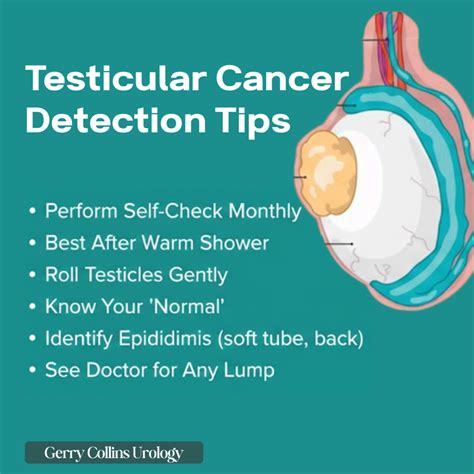 Testicular Cancer A Guide To Early Detection And Specialist Care