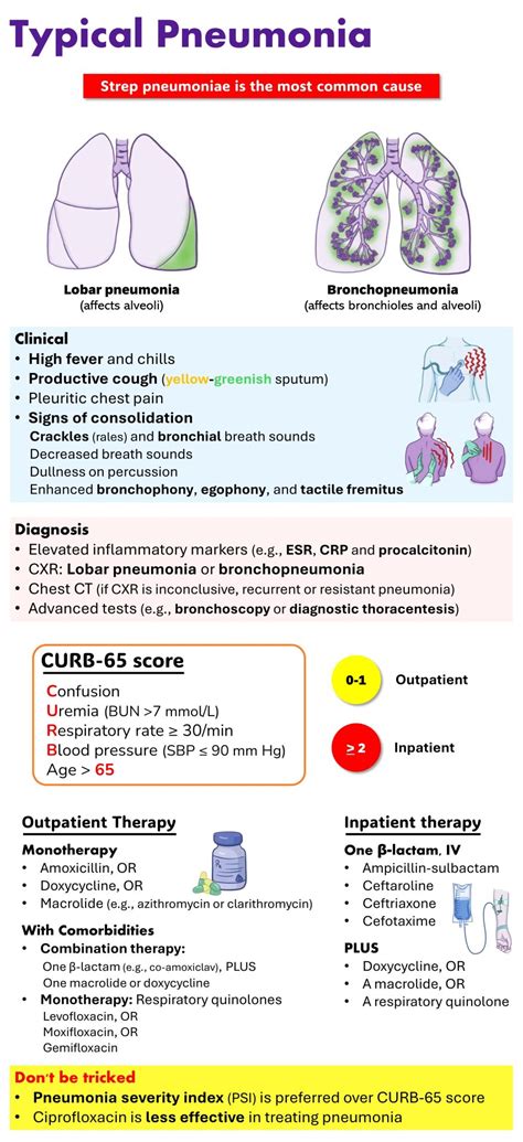 Typical Pneumonia Medicine Keys For MRCPs