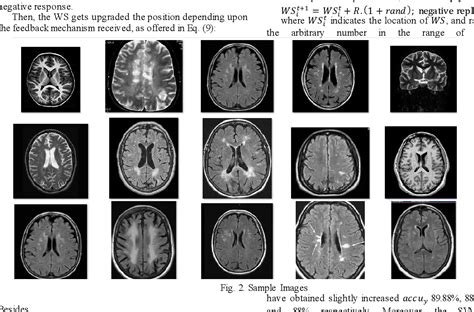 Figure 2 From Automated Brain Tumor Diagnosis Using Residual Network With Optimal Kernel Extreme