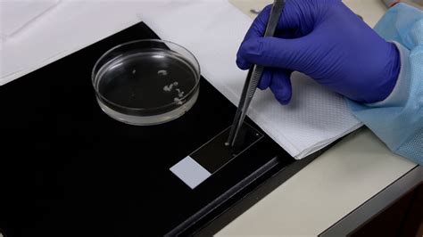 Video 3d Imaging Of The Liver Extracellular Matrix In A Mouse Model Of Non Alcoholic