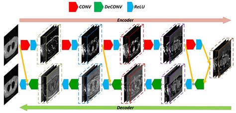 low dose ct with a residual encoder decoder convolutional neural
