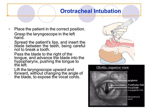 Airway Management Intubation 2ppt