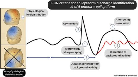 Criteria For Epileptiform Eeg Discharges Genspark