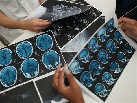 How Can Neuroquant Aid In Brain Health Diagnosis Michigan Diagnostics