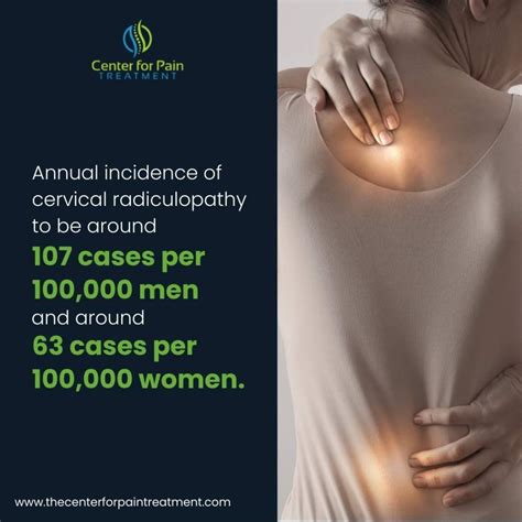 Cervical Radiculopathy Pinched Nerve All You Need To Know Center