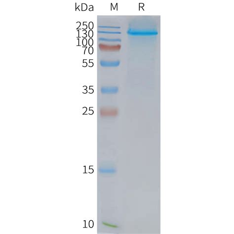 Human Npc1l1 Full Length Protein Synthetic Nanodisc Dima Biotechnology