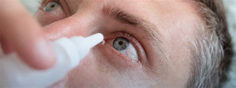 Dry Eye And Blepharitis Treatment In Dubai Ophthalmology Care