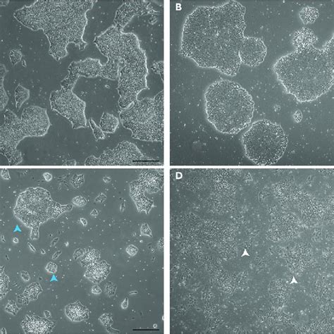 Figure1 Morphology Of Ipsc Colonies For Setting Up Rpe Differentiation