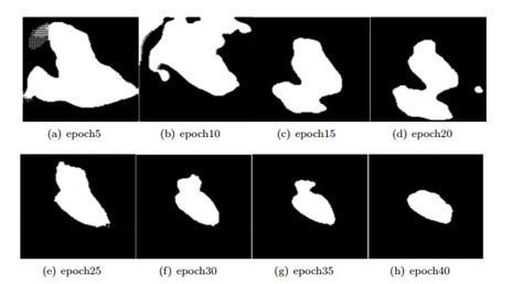A Distance Function Based Cascaded Neural Network For Accurate Polyps