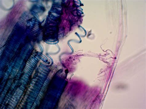 What Is The Difference Between Protoxylem And Metaxylem Pediaa Com