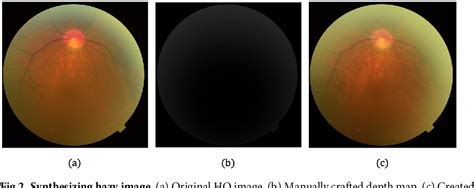 Figure 1 From A Deep Learning Based Framework For Retinal Fundus Image Enhancement Semantic