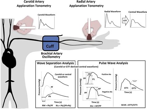 Carotid Pulse Wave