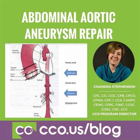 Abdominal Aortic Aneurysm Repair Coding Cpt Coding