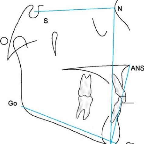Angular Measurements Download Scientific Diagram