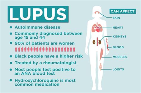 Treatment For Lupus Philadelphia Holistic Clinic Dr Tsan And Associates