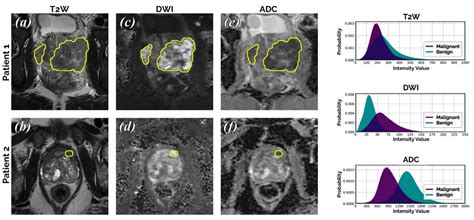 medical imaging datasets intelligent clinical care center ic3