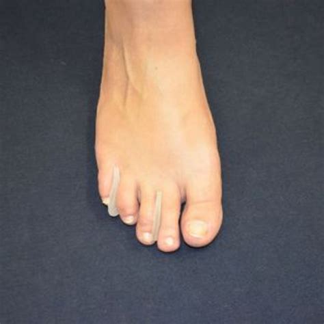 Foot Supply Store Interdigital Corn Pad Toe Spacer One Eighth Inch Foam