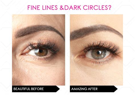 Restore Youthful Eyes Powerful Eye Lift Serum Duo