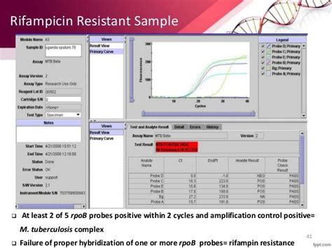 lpa and genexpert cbnaat xpert mtb rif