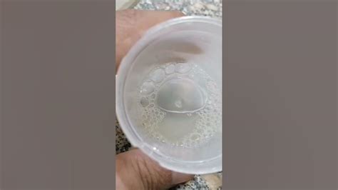 شاهد قراءة عينة سائل منوى بها رغاويتاثير الرغاوى علي جودة السائل