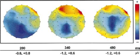 Grand Averaged Scalp Topographies For The Effect Of Interval Predicted Download Scientific