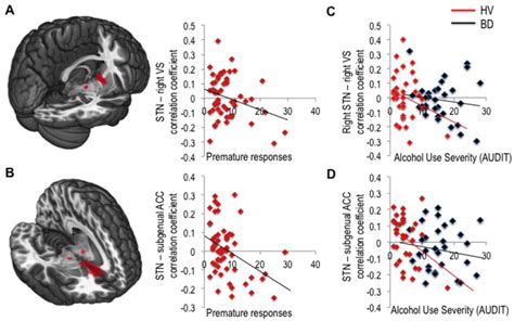 Neural Correlates Of Waiting Impulsivity And Alcohol Use Severity