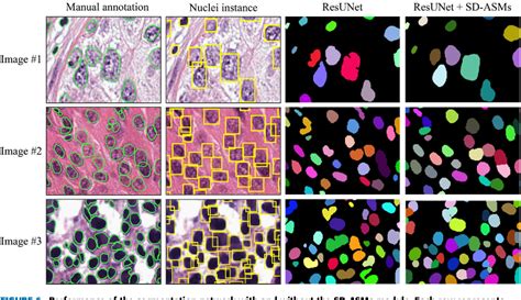 Figure 6 From Softmax Driven Active Shape Model For Segmenting Crowded Objects In Digital