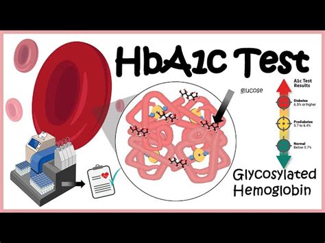 Lab Test Hemoglobin A C Hba C Discount Wholesalers Oceanproperty Co Th