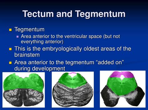 Ppt Brain Stem I Powerpoint Presentation Free Download Id 4674666