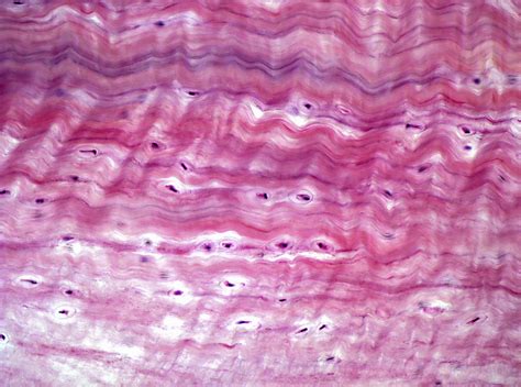 Fibrocartilage Histology