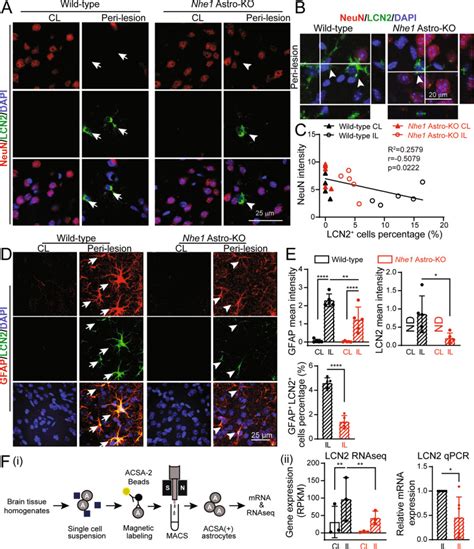 Nox Activation In Reactive Astrocytes Regulates Astrocytic Lcn2 Expression And Neurodegeneration