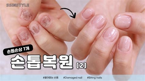 극손상 손톱이 복구되는 6개월 과정😆 손톱이 7개나 심각하게 손상된 고객님 2부 Youtube
