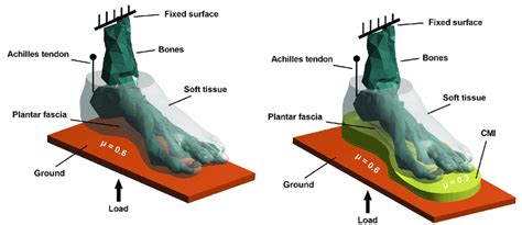 Finite Element Analysis Model Of The Foot Showing The Foot A Without