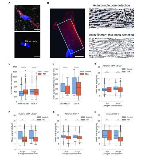 Nuclear Shape And Actin Bundle Network Properties A Exemplary Download Scientific Diagram