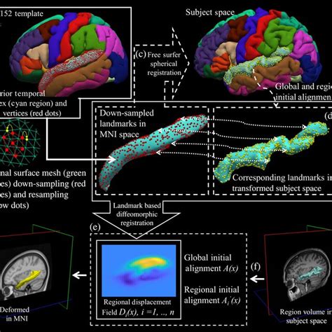 The Pipeline For The Landmark‐guided Region‐based Spatial Normalization Download Scientific