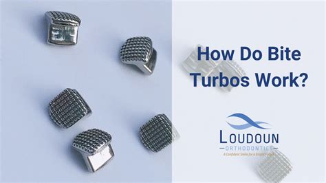 How Do Bite Turbos Work Loudoun Orthodontics